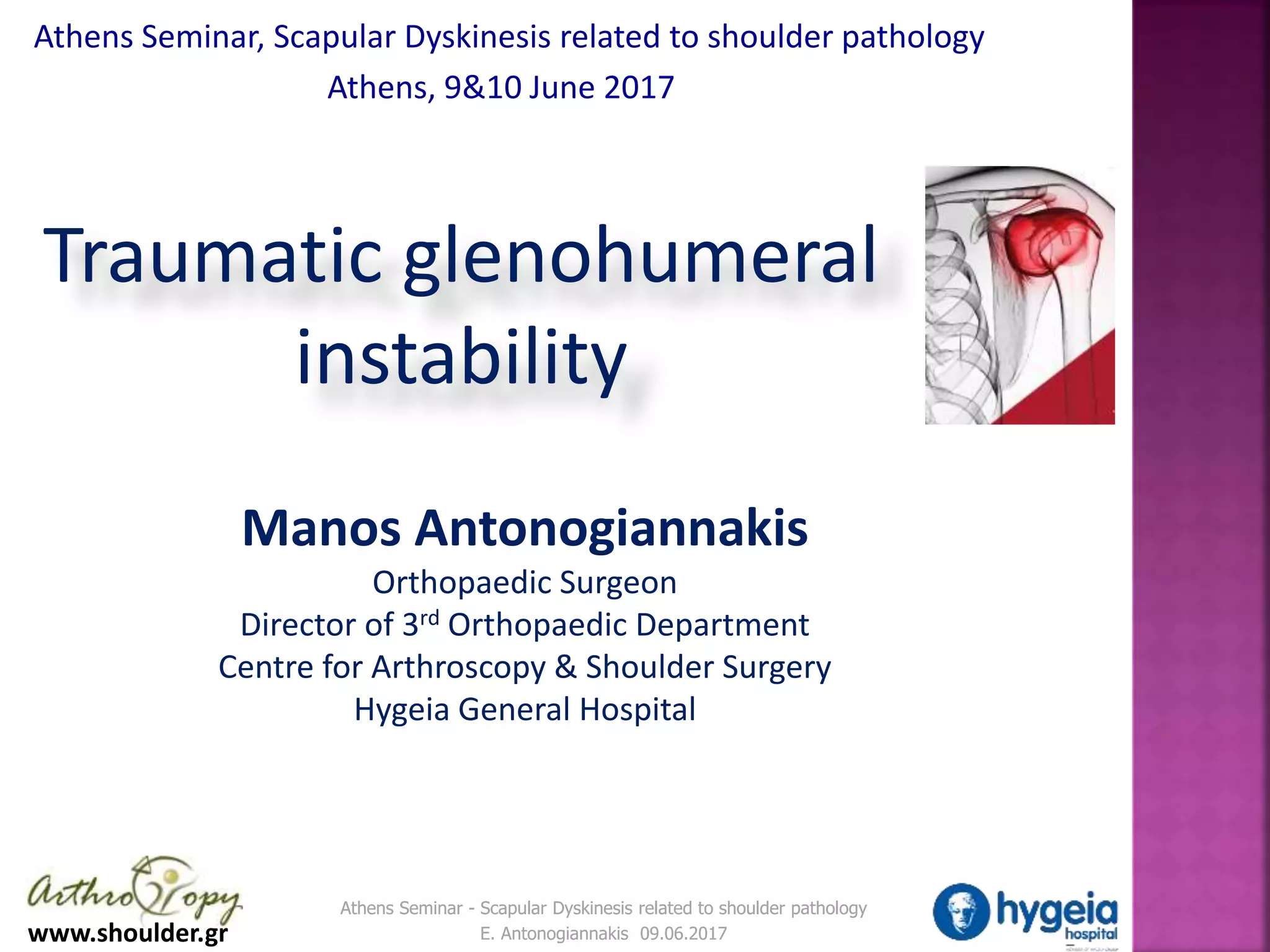 Traumatic glenohumeral instability final | PPTX