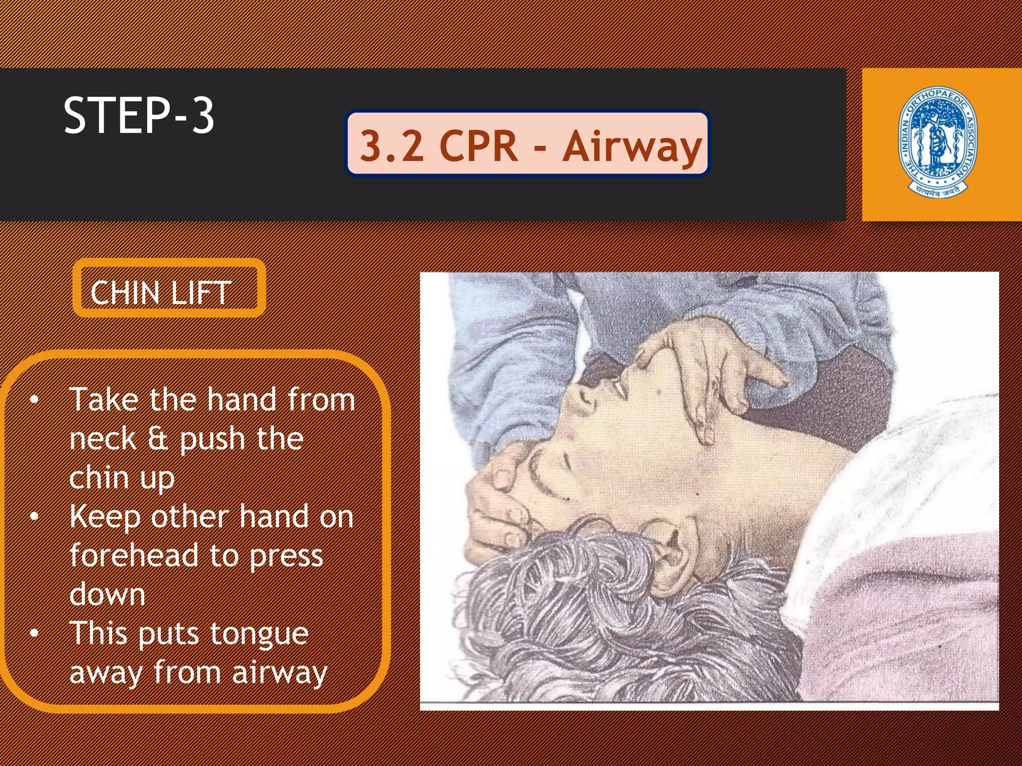 Road safety and first aid after trauma | PPTX