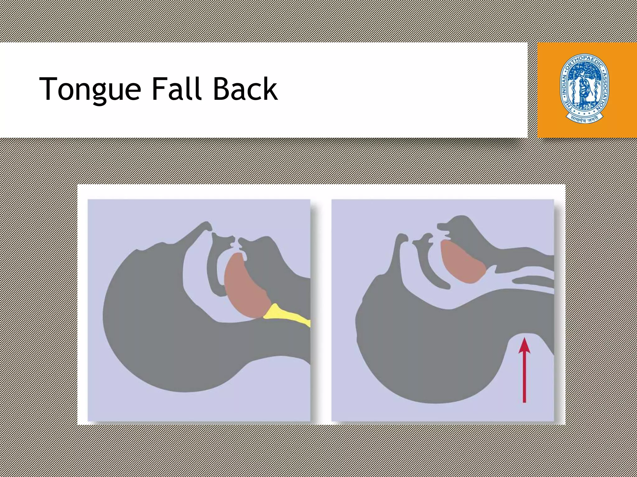 Road safety and first aid after trauma | PPTX
