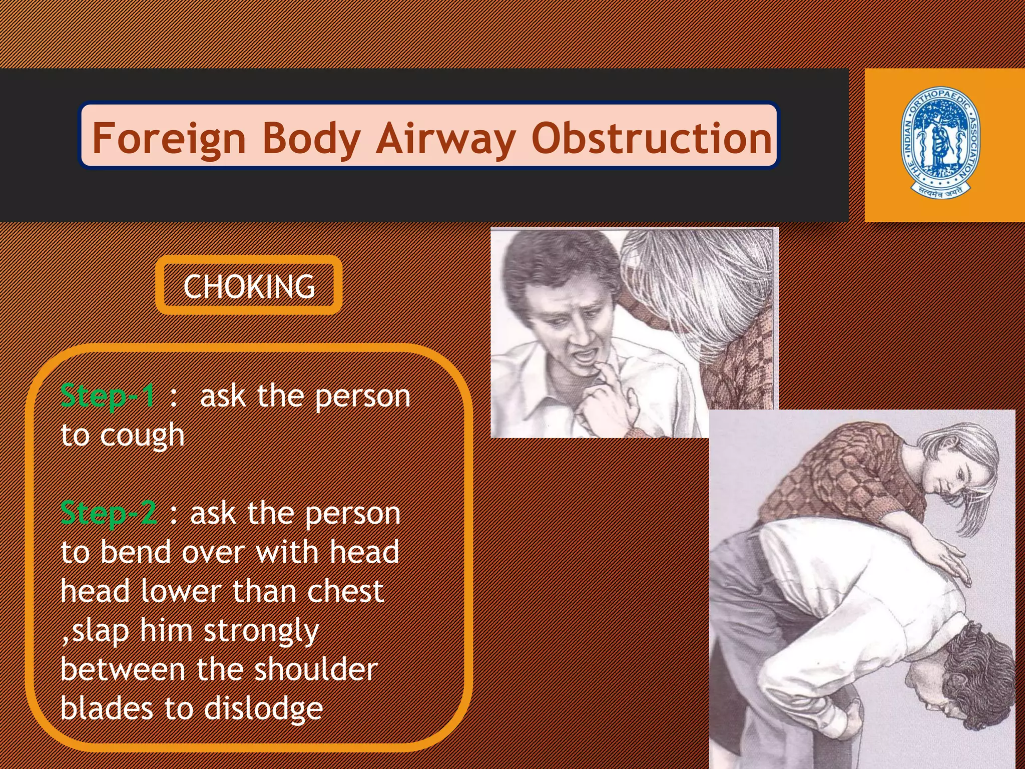 Road safety and first aid after trauma | PPTX