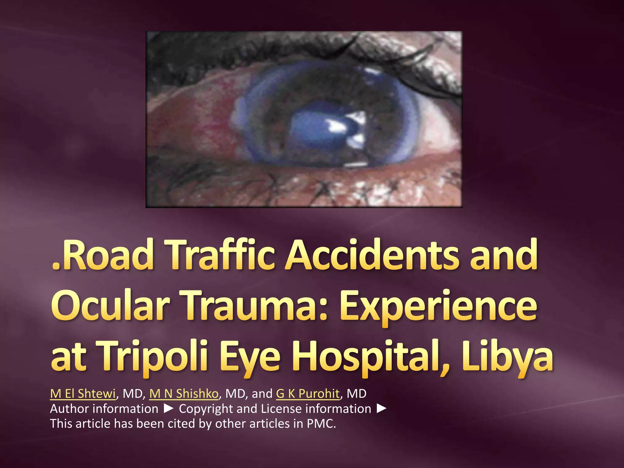 Road traffic accidents and ocular trauma | PPTX