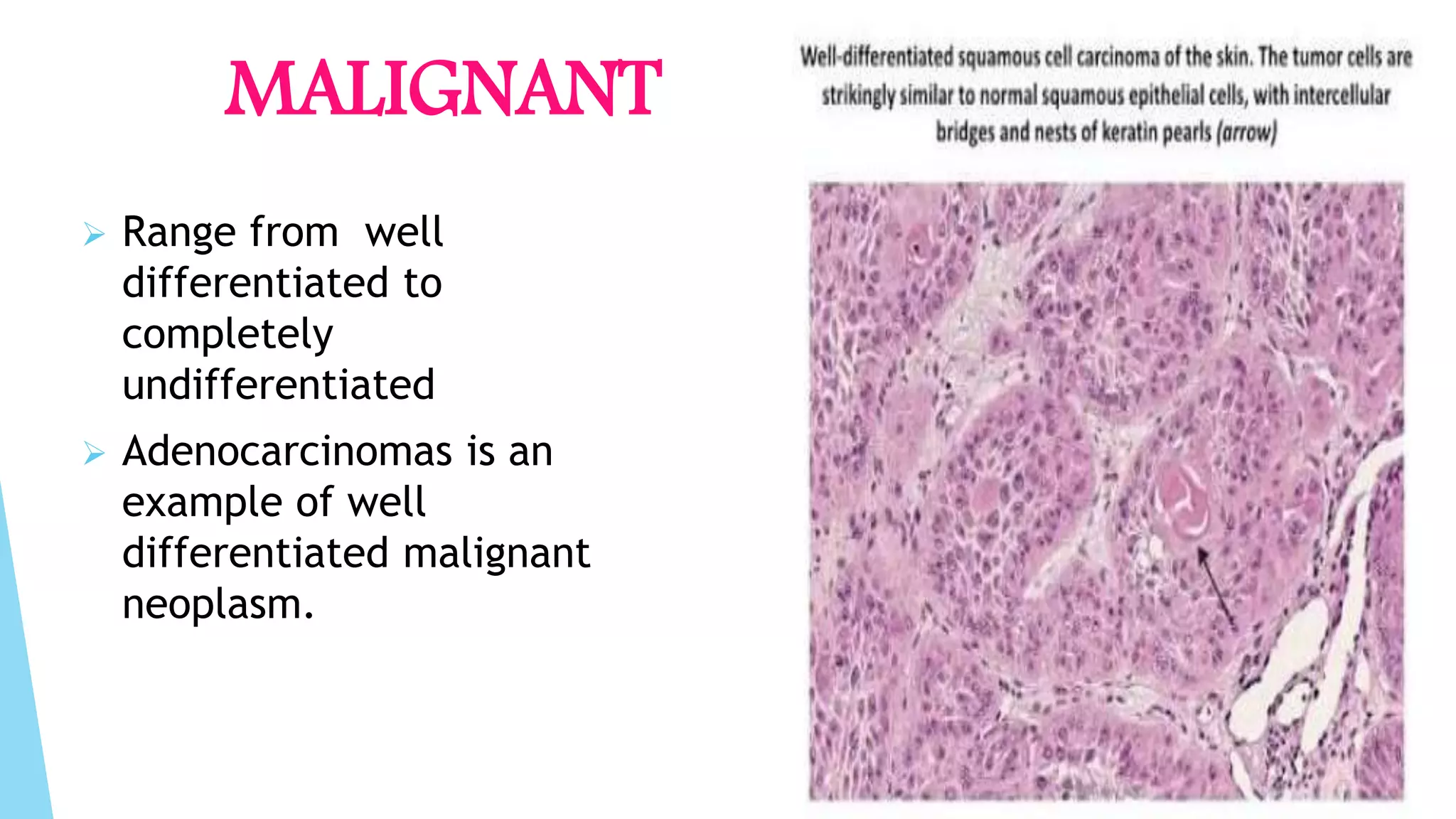 DIFFERENCE BETWEEN BENIGN AND MALIGNANT NEOPLASM (CANCER) | PPTX