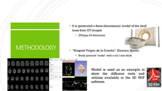 Use of 3D PDF (portable document format) in radiological models: Tools and applications | PDF