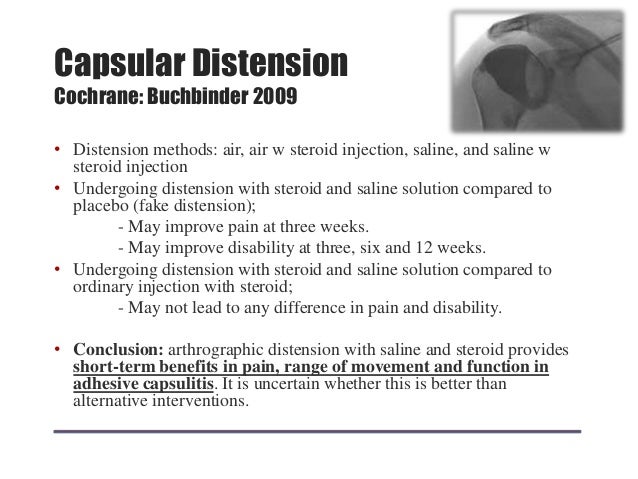 Robertson EBP Shoulder Update