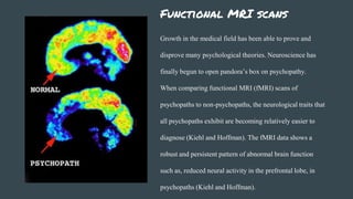 Sociopathy Brain Scan