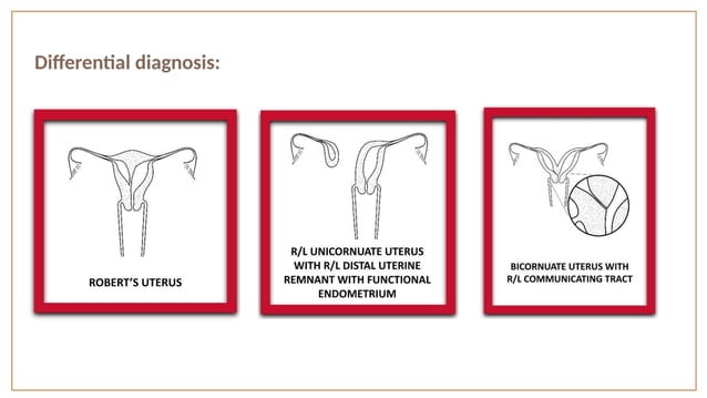 Robert's Uterus to Presentation gyane obs | PPT
