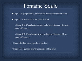Peripheral Artery Disease - Case Presentation | PPT
