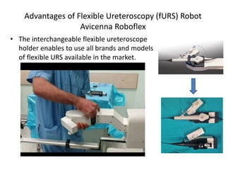 World’s First Flexible Ureteroscopy Robot | PDF