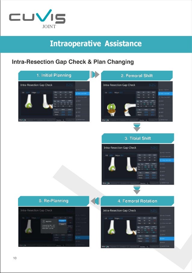 Know all about Latest CUVIS JOINT Robotic System Online at Meril Life | PDF