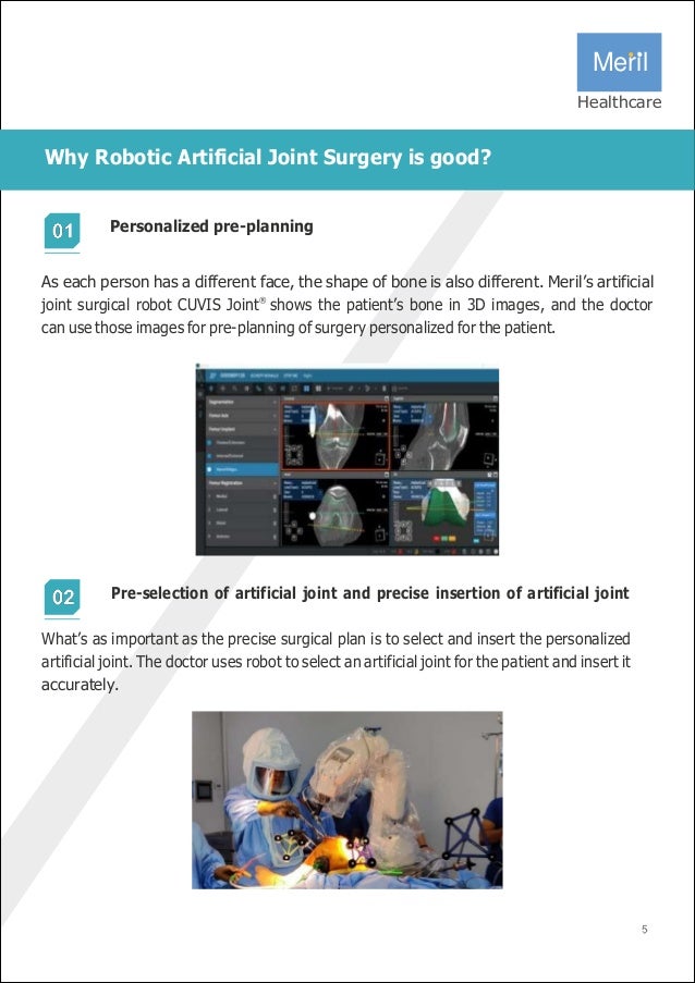 Know all about Latest CUVIS JOINT Robotic System Online at Meril Life | PDF
