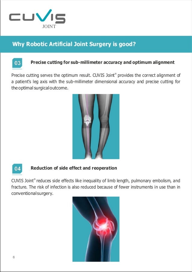 Know all about Latest CUVIS JOINT Robotic System Online at Meril Life | PDF