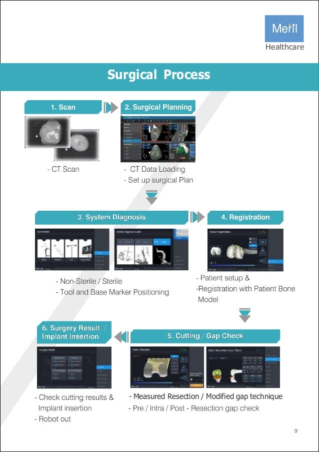 Know all about Latest CUVIS JOINT Robotic System Online at Meril Life | PDF