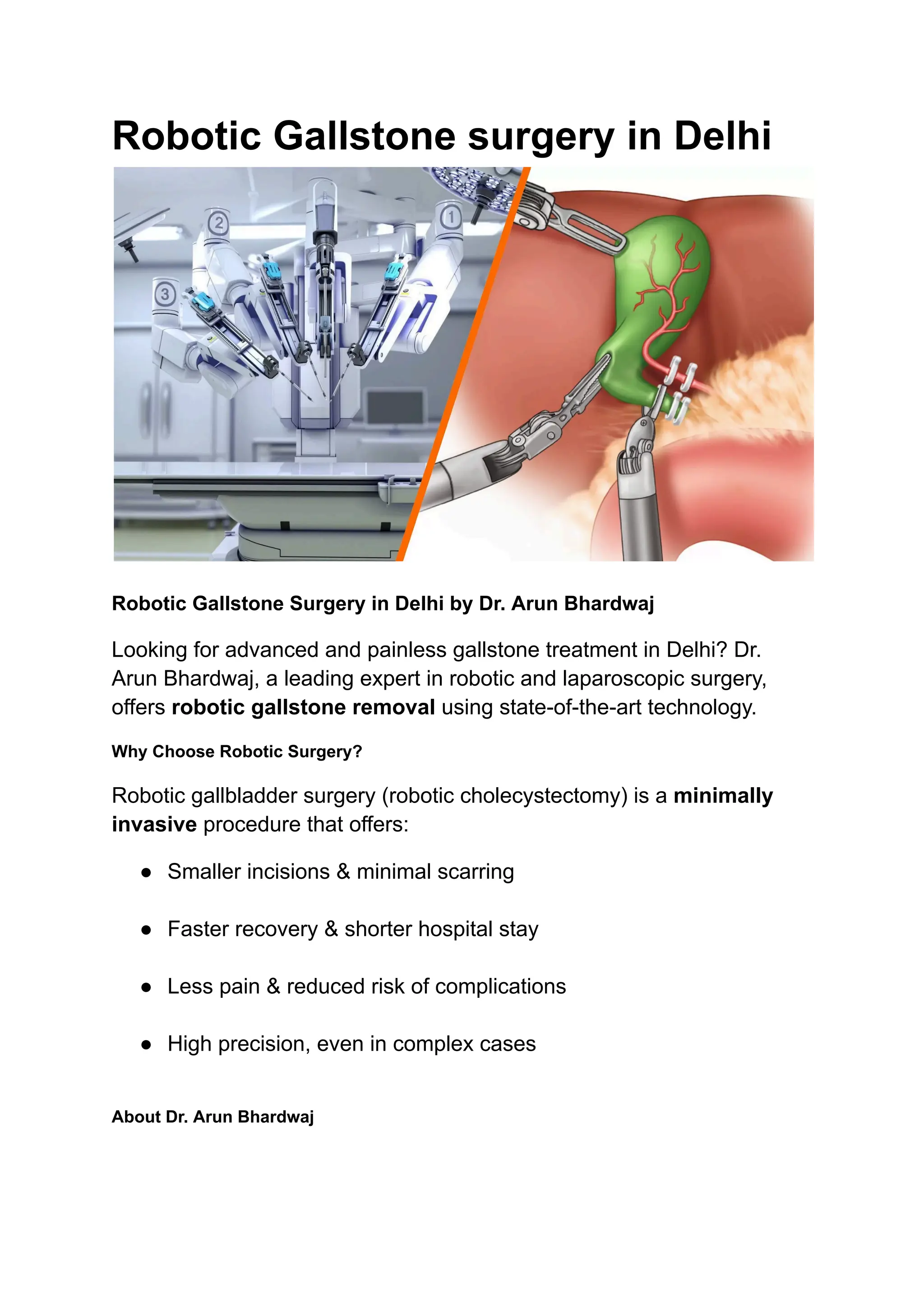 Robotic Gallstone surgery in Delhi .pdf