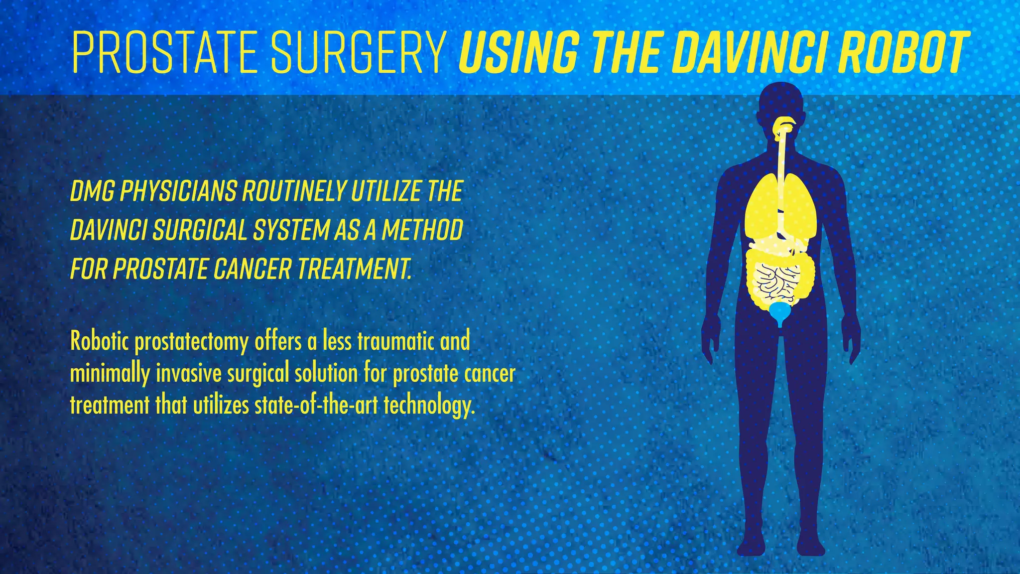 Robotic prostectomy infographic_2017 | PPT