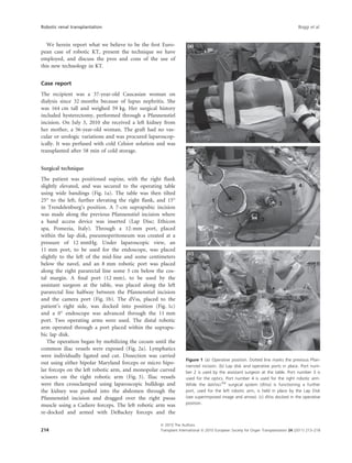 Robotic renal transplantation first european case boggi | PDF | Robotics | Technology & Computing