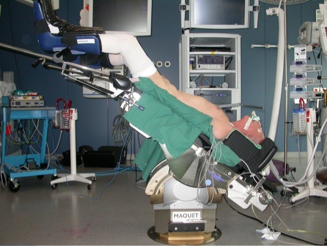 Robotic Sacrocolpopexy OLV