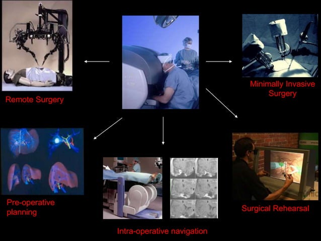 Robotics in oral and maxilllofacial surgery | PPTX | Ear, Nose and ...