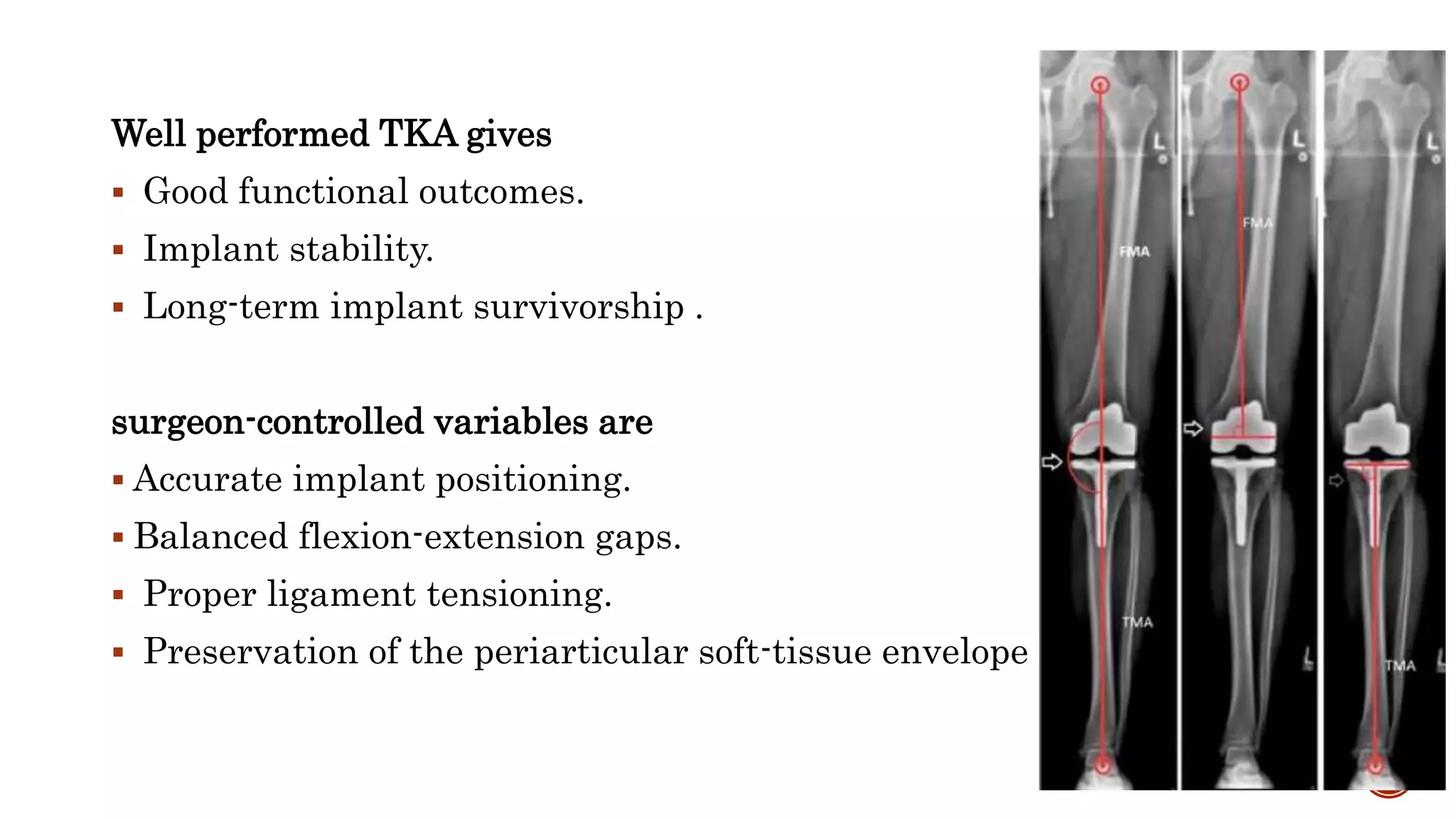 ROBOTICS IN TKR.pptx