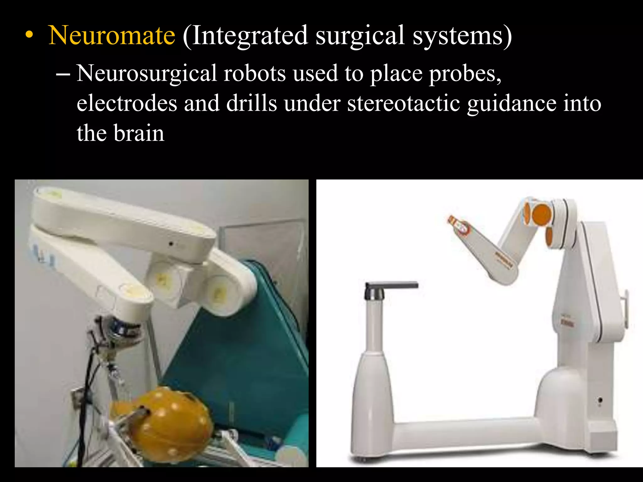 Robotic surgery in ENT | PPTX