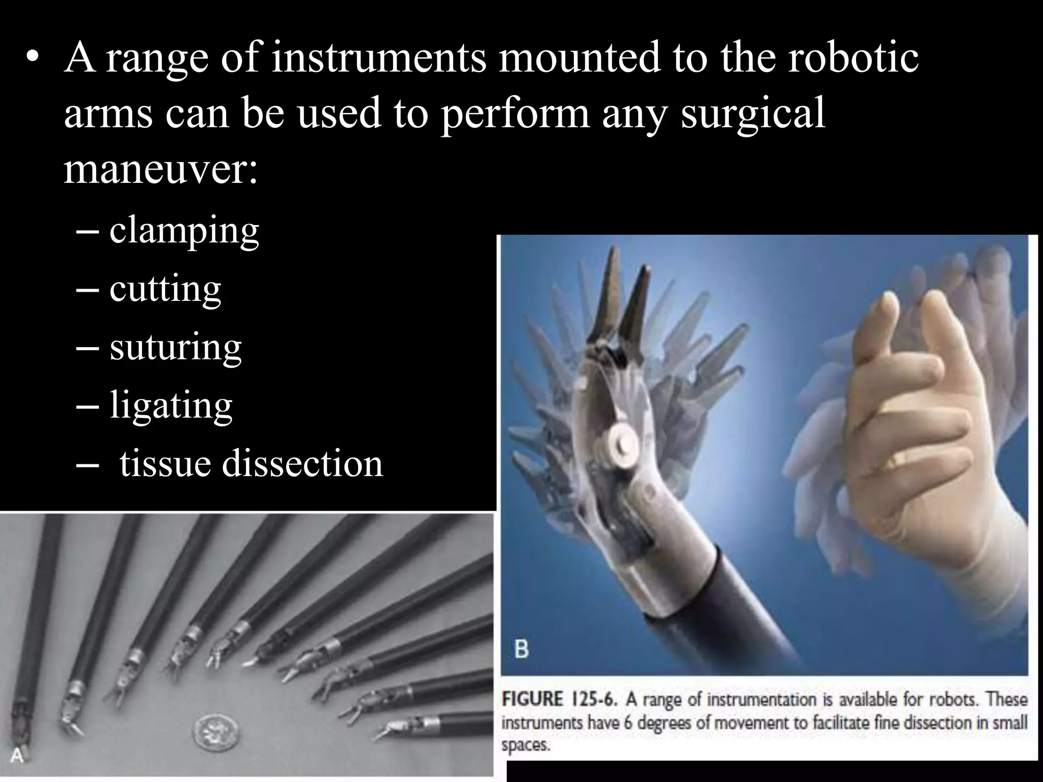 Robotic surgery in ENT | PPTX
