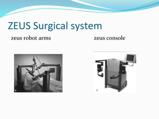 Robotic Telesurgery Robotic surgery is : “ROBOT ASSISTED” SURGERY, Surgeon decides and gives ...