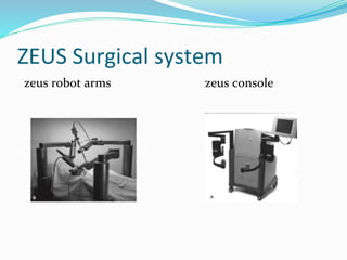 Robotic surgery and its concepts | PPTX