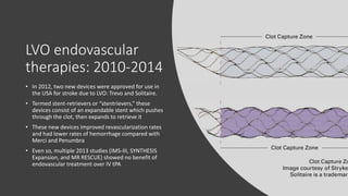 Roche dawn ibs_506 | PPT