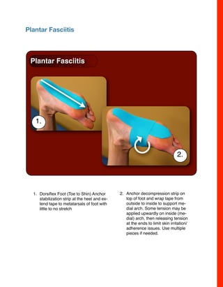 Rock tape powertaping for common injuries | PDF