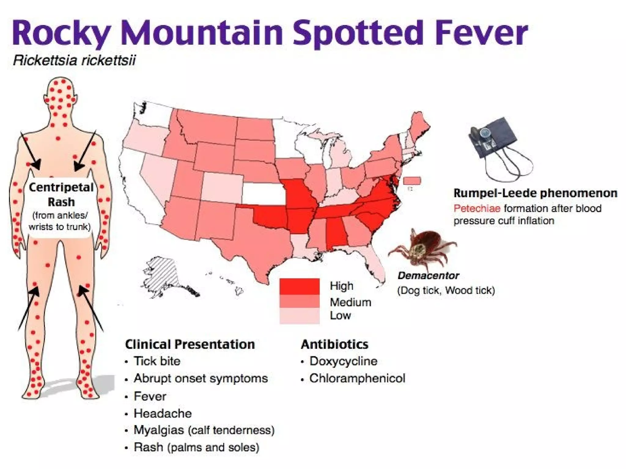 Rocky mountain spotted fever | PPT