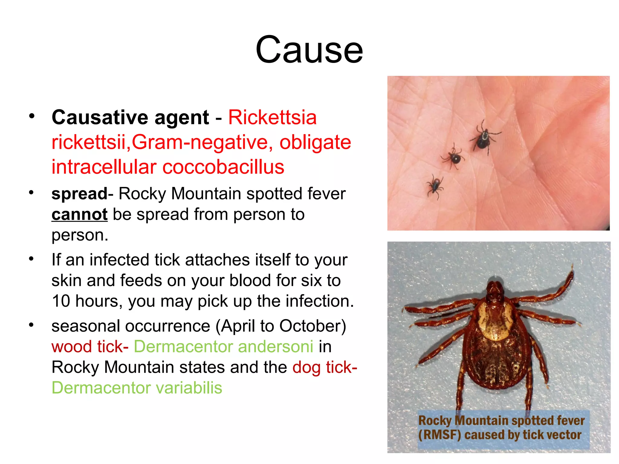 Rocky mountain spotted fever | PPT