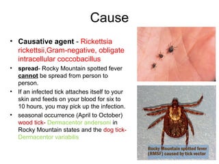 Rocky mountain spotted fever | PPT