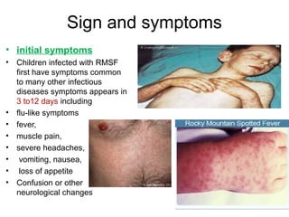Rocky mountain spotted fever | PPT