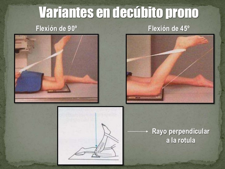 Proyecciones de Rodilla y Tobillo en Radiología Convencional