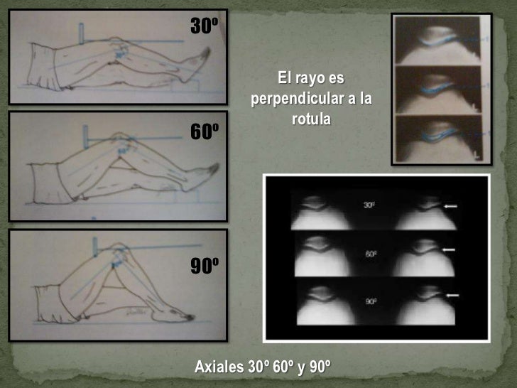 Proyecciones de Rodilla y Tobillo en Radiología Convencional