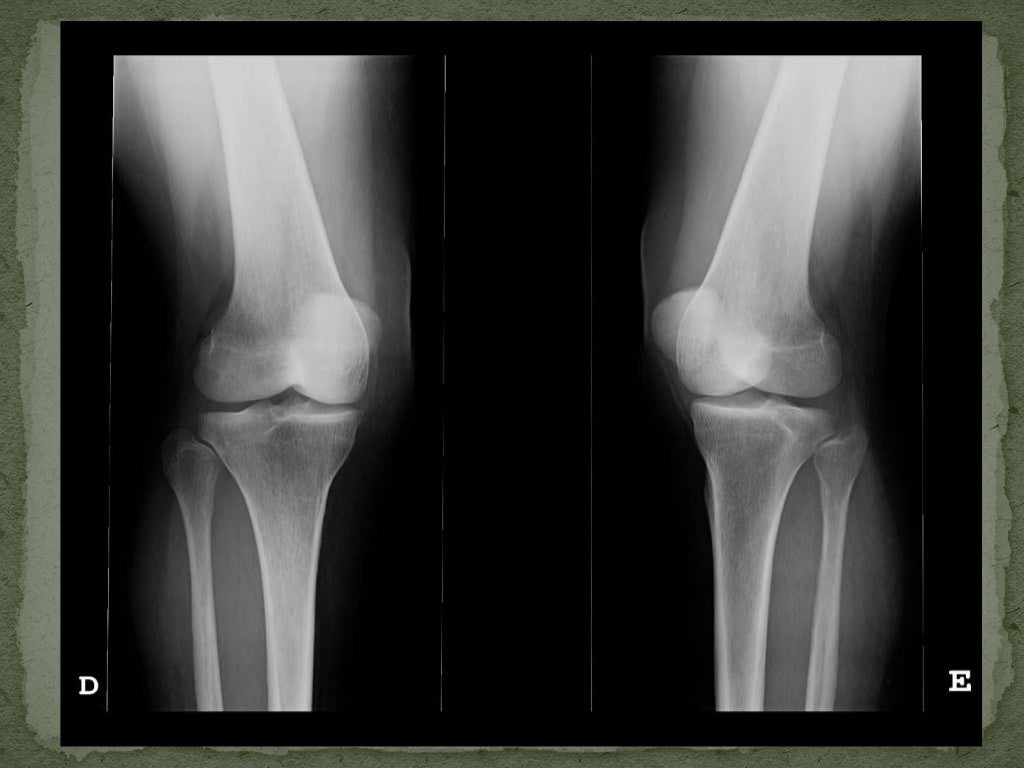 Proyecciones de Rodilla y Tobillo en Radiología Convencional