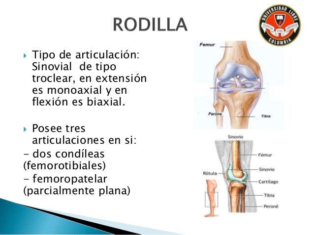 Rodilla