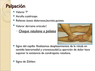 Rodilla en AP | PPT