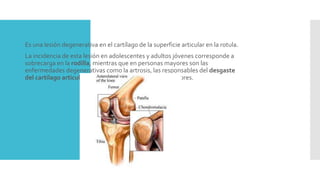 lesiones comunes de la rodilla en la deporte | PPTX