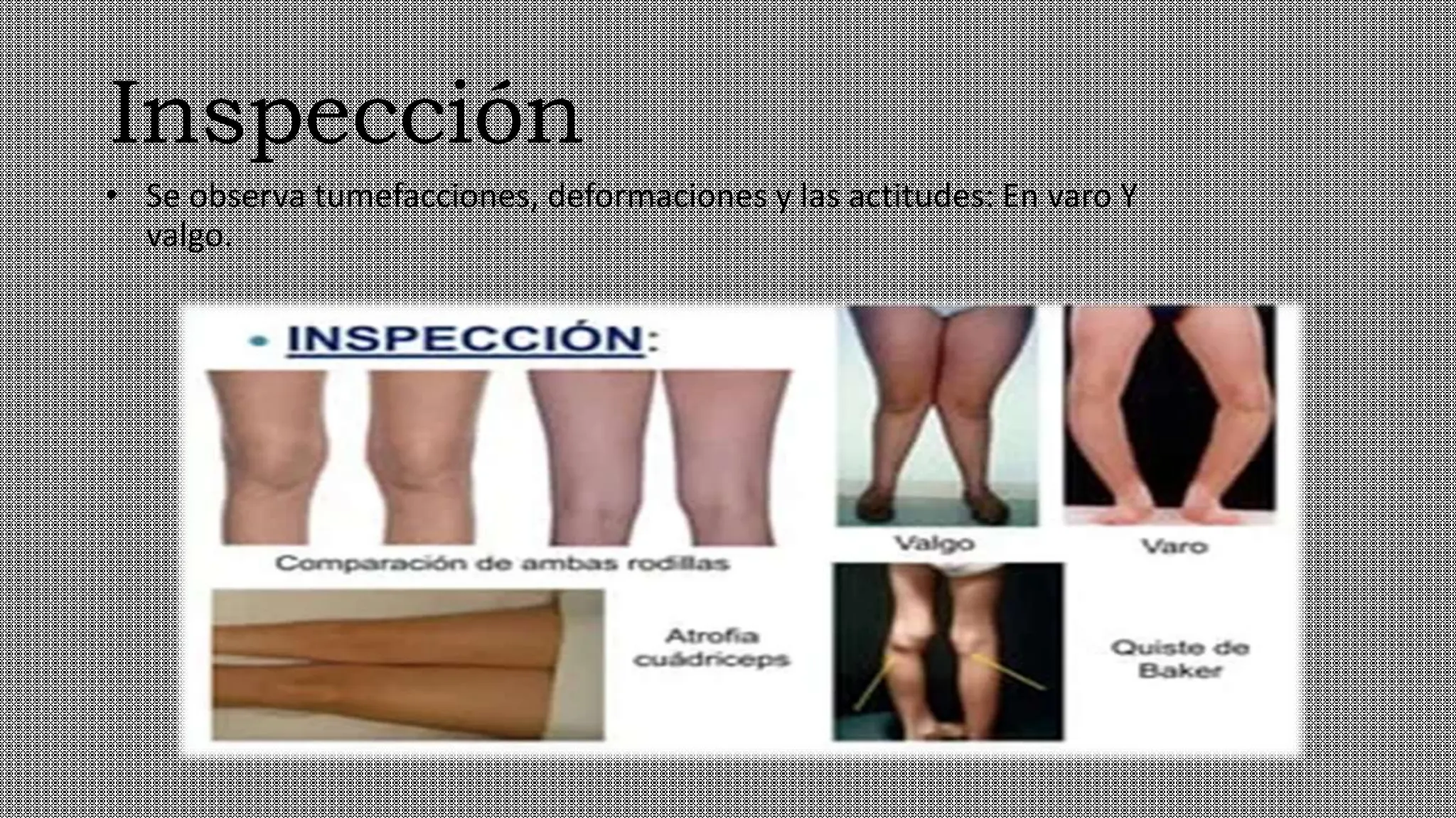 rodilla examen fisico materia reumatologia pptx | PPTX