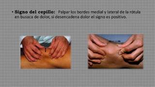 rodilla examen fisico materia reumatologia pptx | PPTX