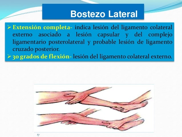 Rodilla traumatica