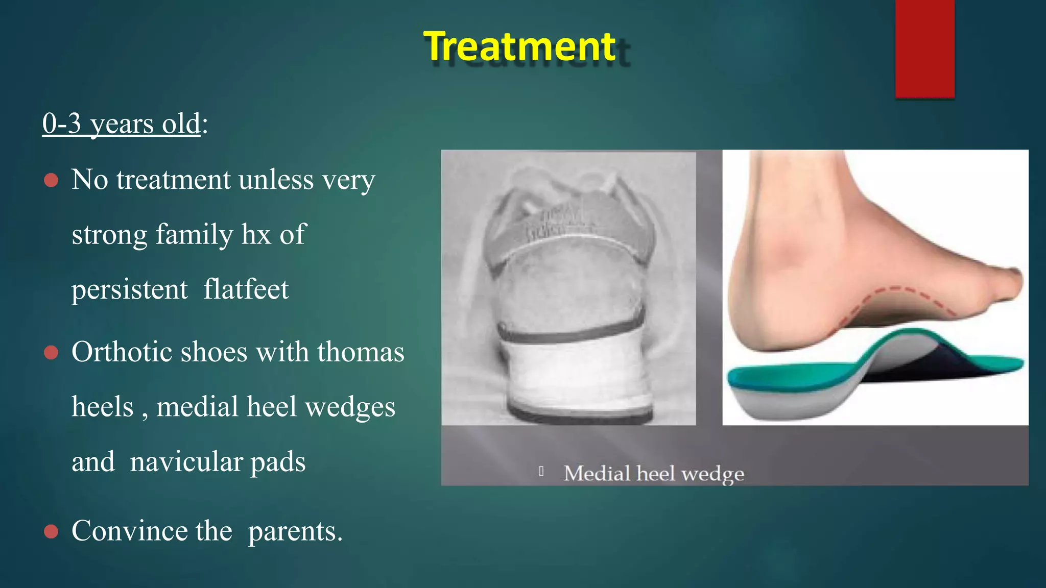 Flat Foot, Tibialis Posterior Tendon Dysfunction & Accessory ...