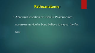 Flat Foot, Tibialis Posterior Tendon Dysfunction & Accessory ...