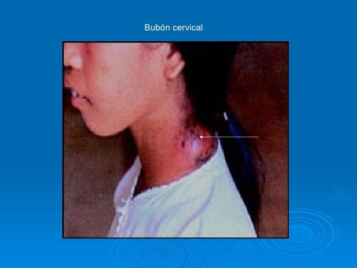 Roedores ySalud Pública