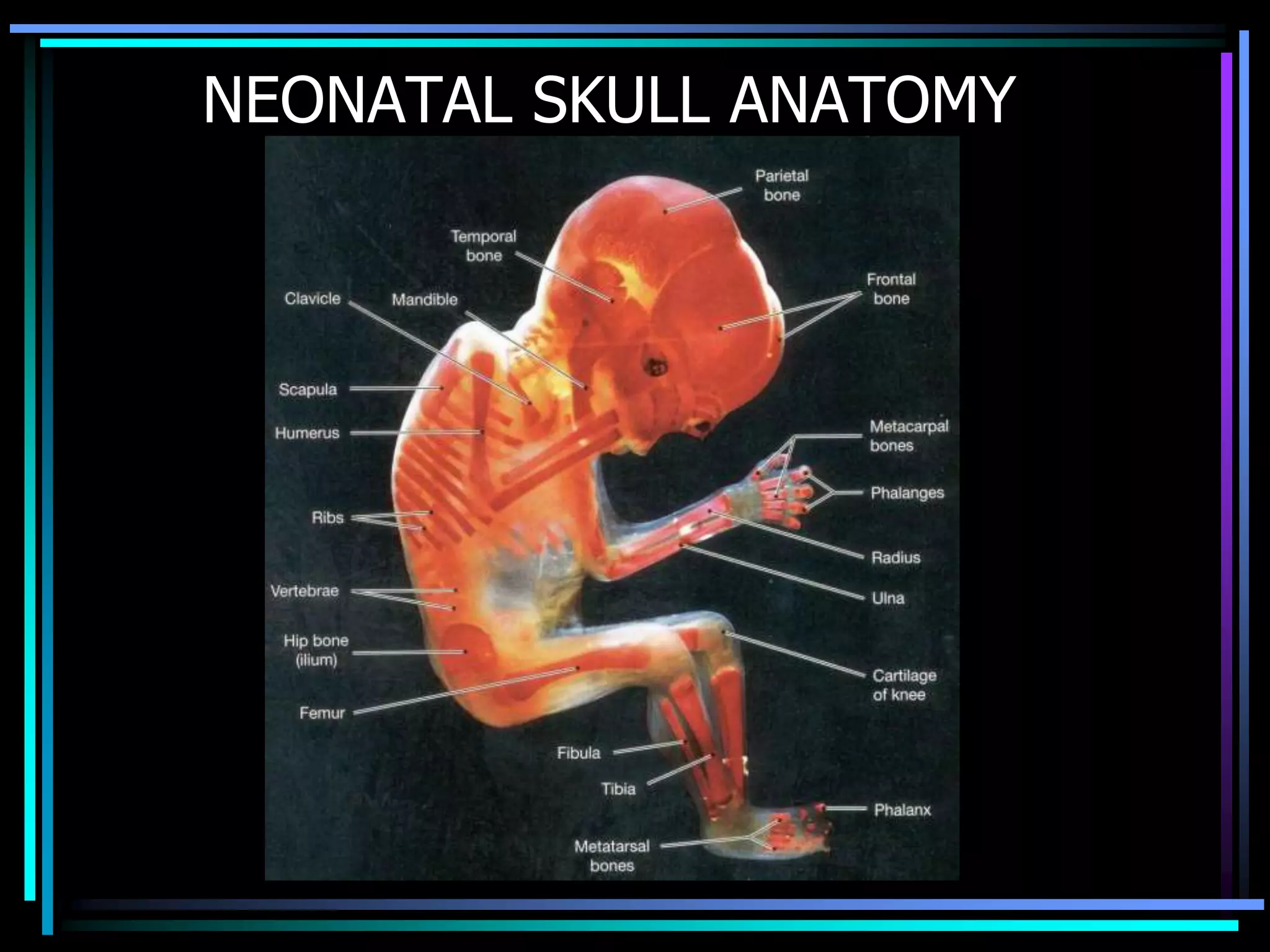 Roentgenology of skull | PPTX
