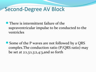 diagnosis of conduction disorders | PPT