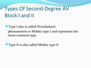 diagnosis of conduction disorders | PPT