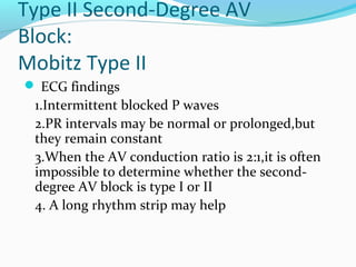 diagnosis of conduction disorders | PPT
