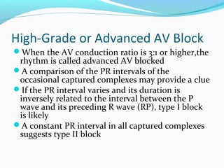 diagnosis of conduction disorders | PPT