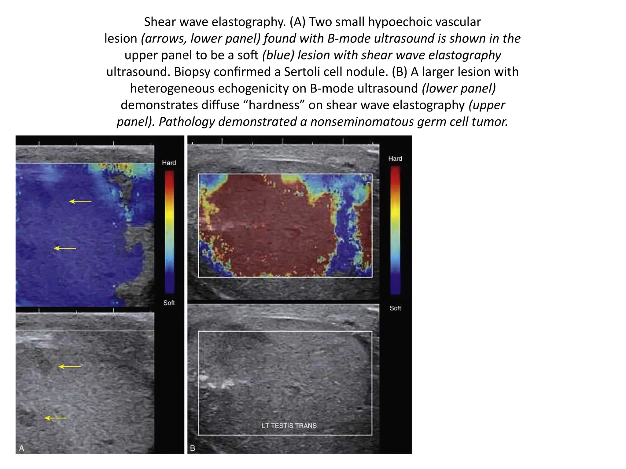 ultrasonography imaging in uro surgery slide | PPT